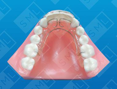 Spring Hawley Retainer U/L , Teeth Movement, Dental Tools | Toronto